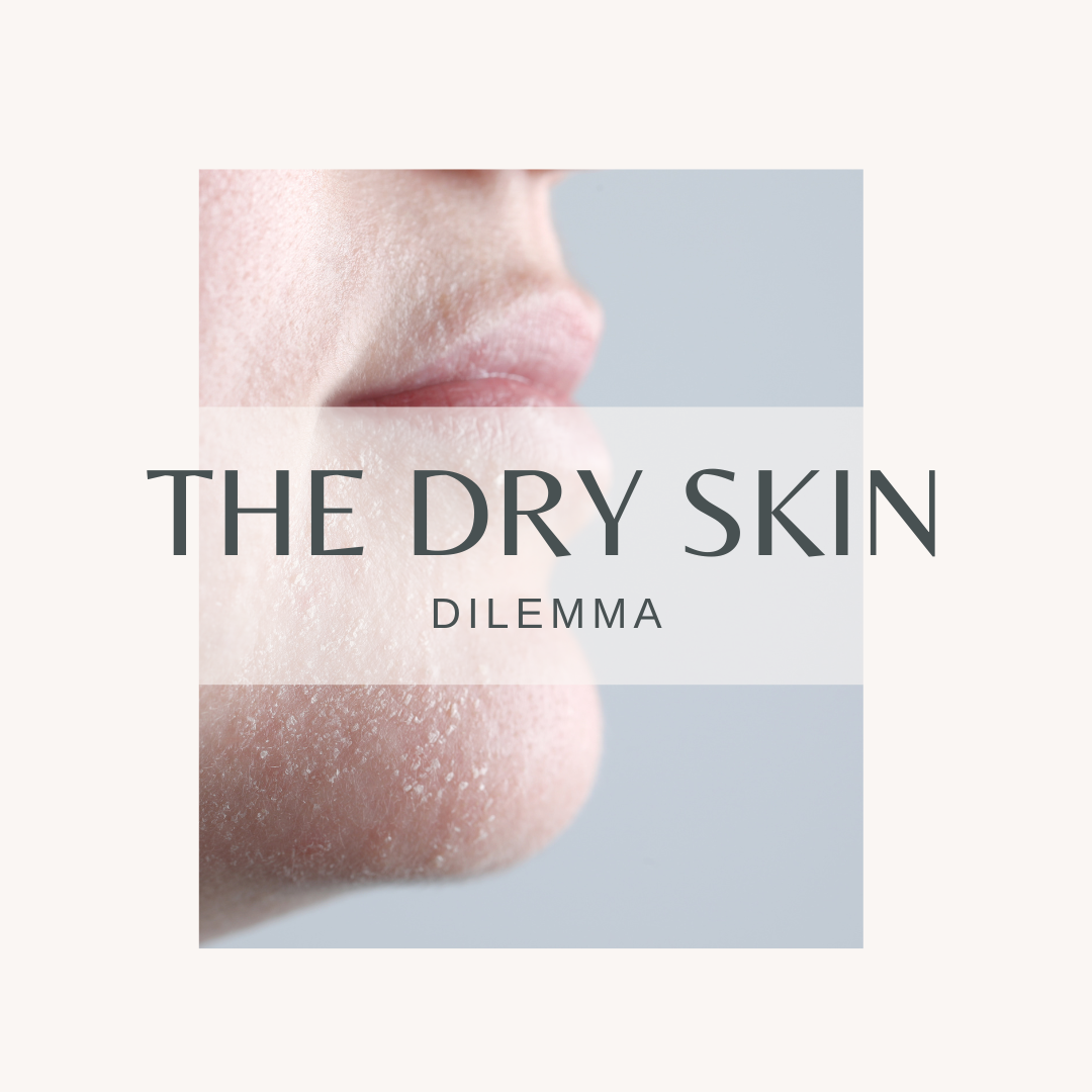 The Dry Skin Dilemma – Janssen Cosmetics West Shop